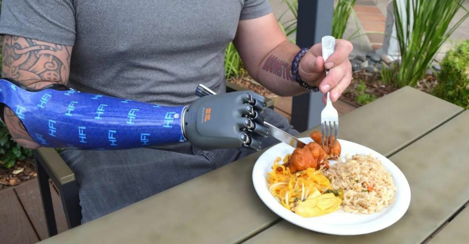 Brain-Machine Interface Firm BrainCo's BrainRobotics Hand Obtains FDA ...